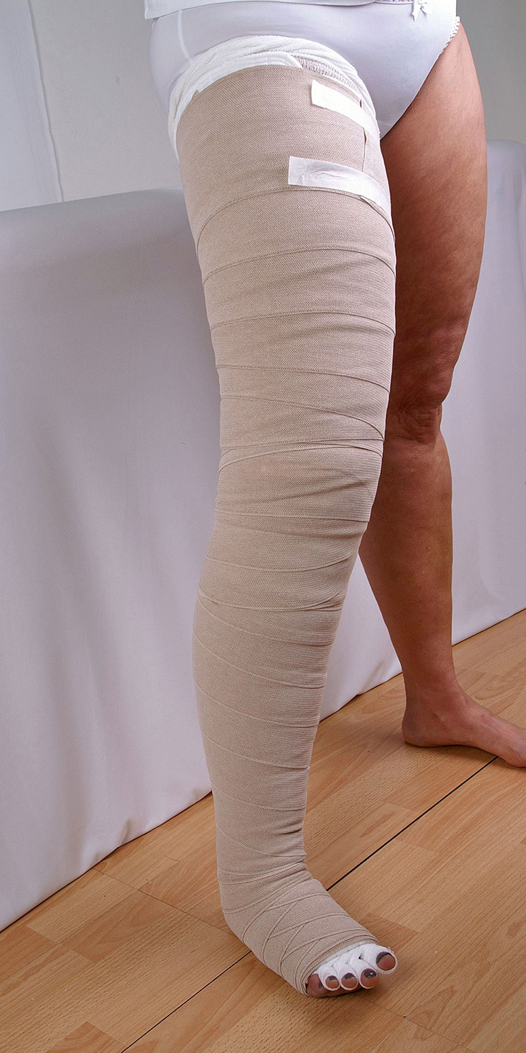 Manuelle Lymphdrainage und Ödemtherapie – praxisedelweiss.ch